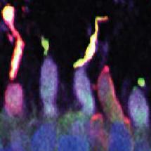 UW study finds photoreceptor cells from retinal organoids can replicate ...